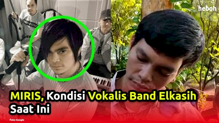 MIRIS! Begini Kondisi Vokalis Band Elkasih Saat Ini! - Heboh ...
